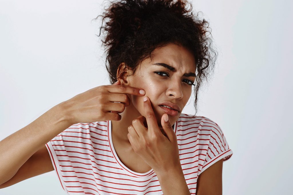 The Psychological Impact of Acne on Mental Health - Kulani Spa