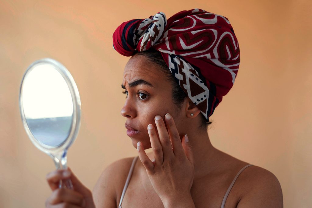 The Psychological Impact of Acne on Mental Health - Kulani Spa